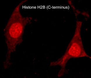 Histone H2B type 1B Antibody (NBP3-23376) | Bio-Techne